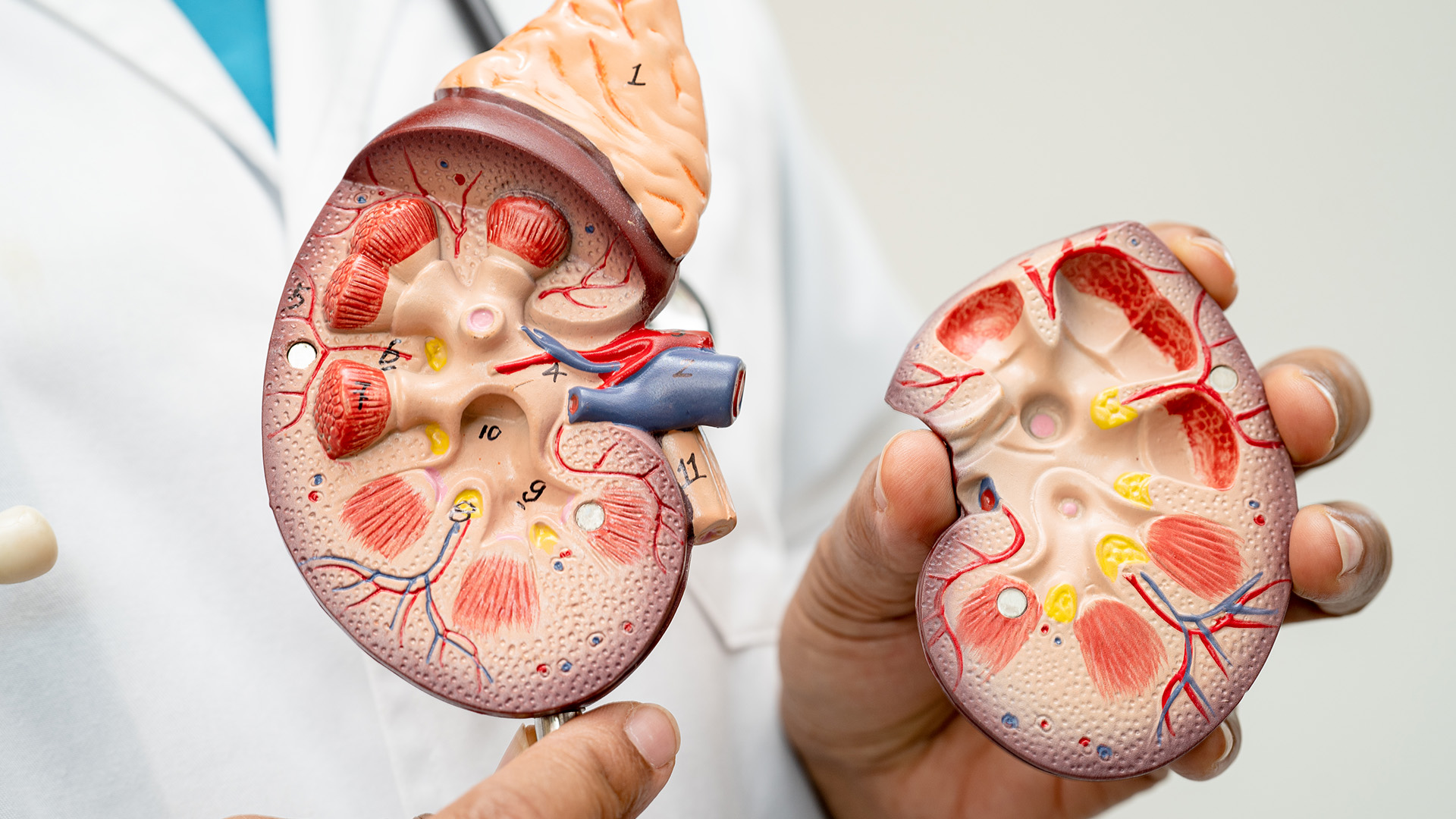 Understanding End-Stage Renal Disease (ESRD): A Guide for Nursing Home Staff